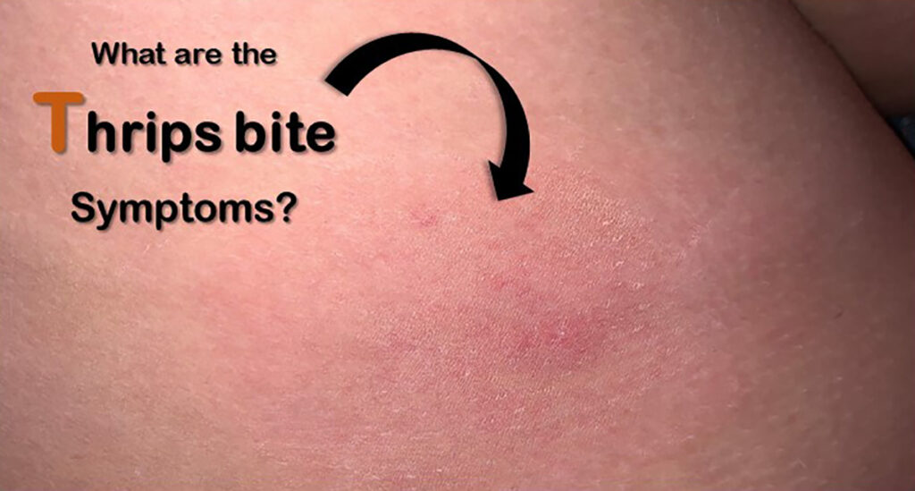 Do Thrips bite? Yes (Symptoms with Pictures + Best Treatments ...